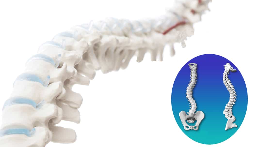 Scolioses, Cyphoses, Lordoses: les réponses du chiropracteur...